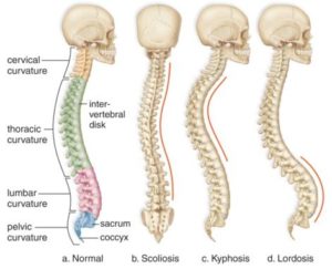 Inversion Therapy for Kyphosis - Being Straight, Strong and Healthy by ...